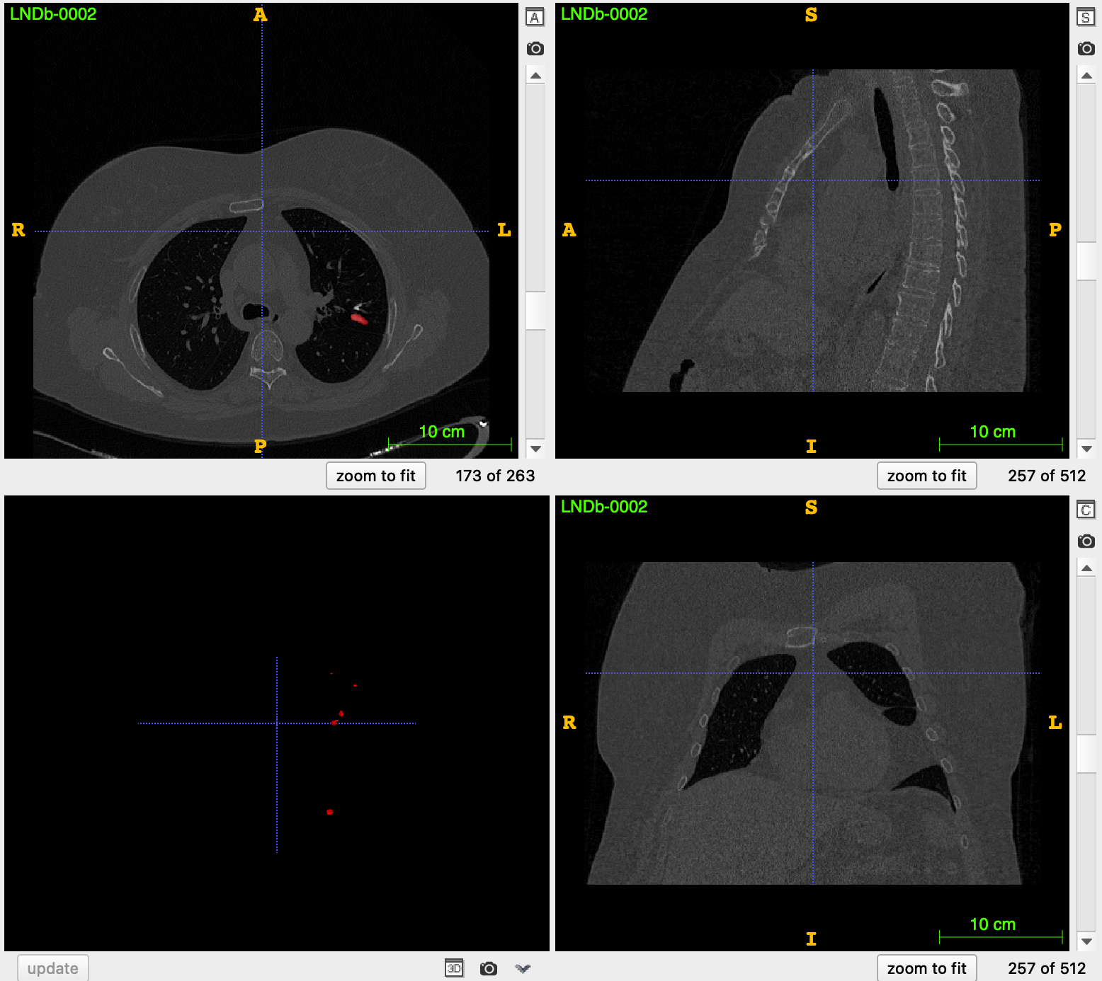 LNDb 数据集介绍 - 知乎