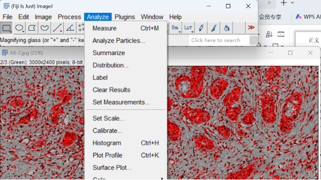 解忧小工具｜保姆式教程！用Image J进行免疫组化分析（IHC score评分） - 知乎