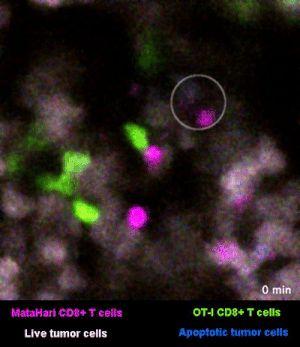 无癌生存11年！全球首位被CAR-T疗法“治愈”的Emily最新打卡照！ - 知乎