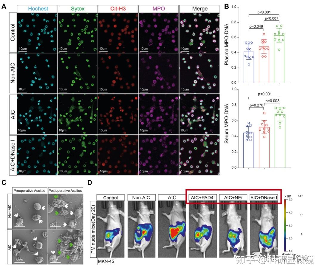通过多篇10+高分文献结果揭示国自然热点中性粒细胞胞外诱捕网（NETs）相关实验 - 知乎