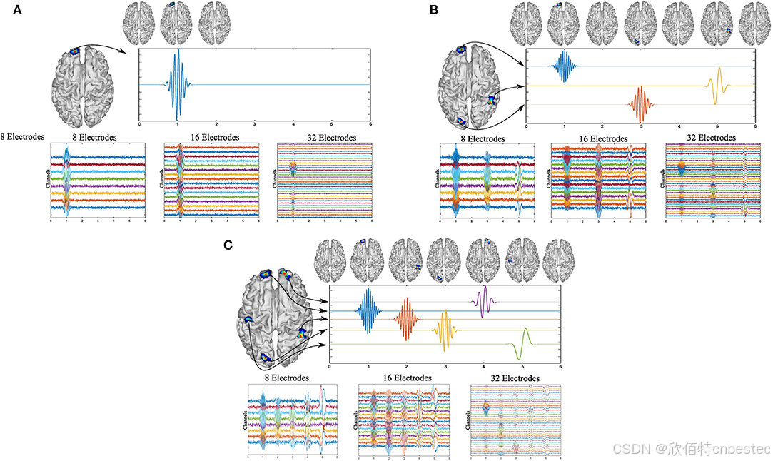 EEG设备的「减法哲学」：Mentalab Explore如何用8通道重构高质量脑电信号？ - 知乎