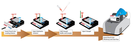 BioFire公司的FilmArray芯片的检测流程 - 知乎