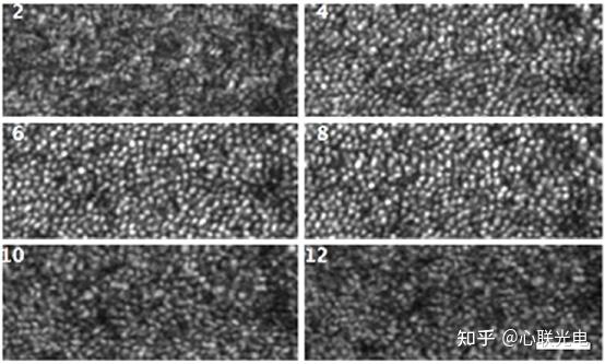 Biomed Opt Express：无波前传感器自适应光学相干断层成像（WSAO-OCT）在人视锥细胞镶嵌体活体成像中的应用 - 知乎