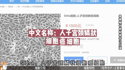 Siha细胞培养，人子宫颈鳞状细胞癌细胞培养攻略 - 丰晖生物 - 知乎