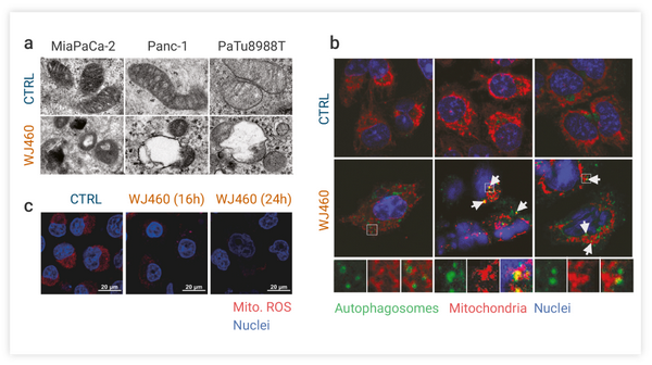 超详细 | 线粒体自噬机制及检测方法大汇总 - 知乎