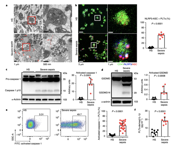 Nature最新大子刊丨脓毒症-血小板-GSDMD-NETs - 知乎