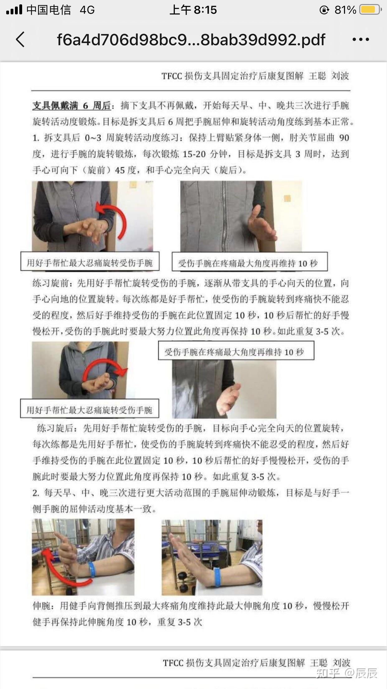 右手tfcc恢复历程 - 知乎