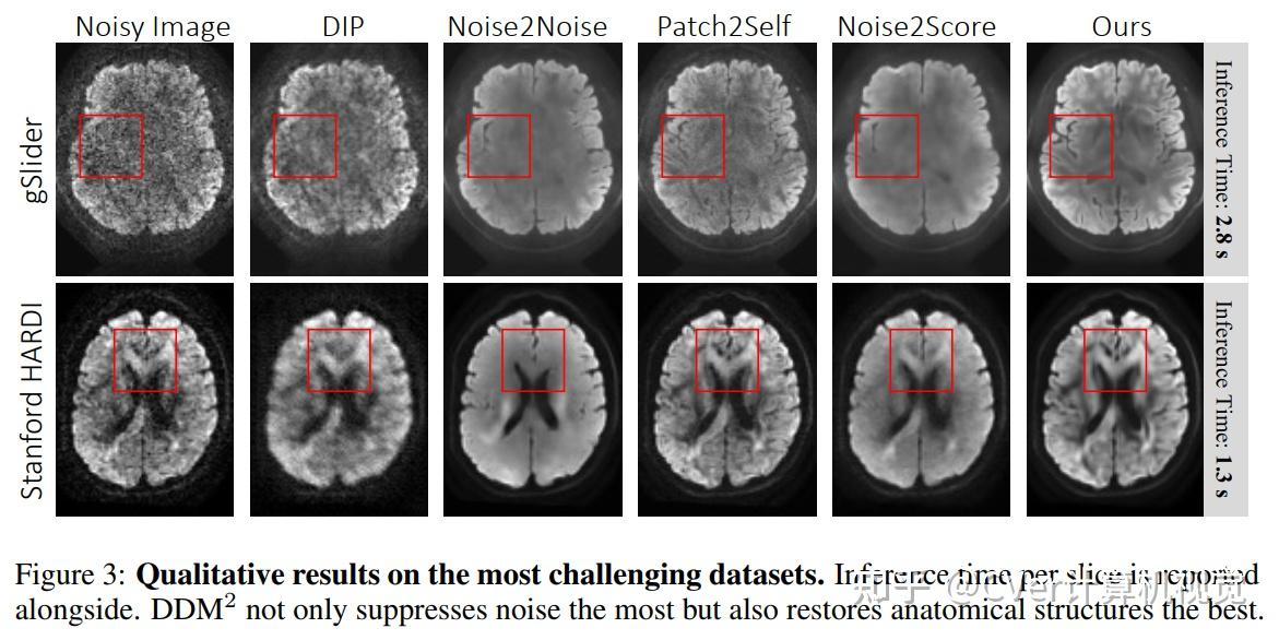 ICLR 2023 | 斯坦福提出DDM2：基于生成扩散模型的自监督扩散MRI去噪 - 知乎