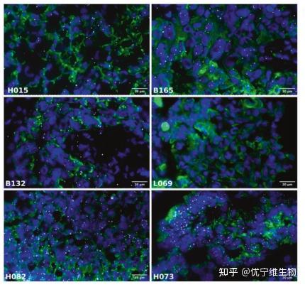 科研干货！Naveni PLA技术&现有文献部分解析 - 知乎