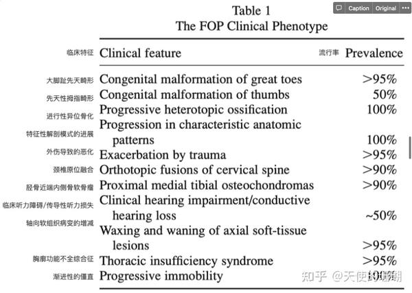 FOP的显性表现（表型） - 知乎