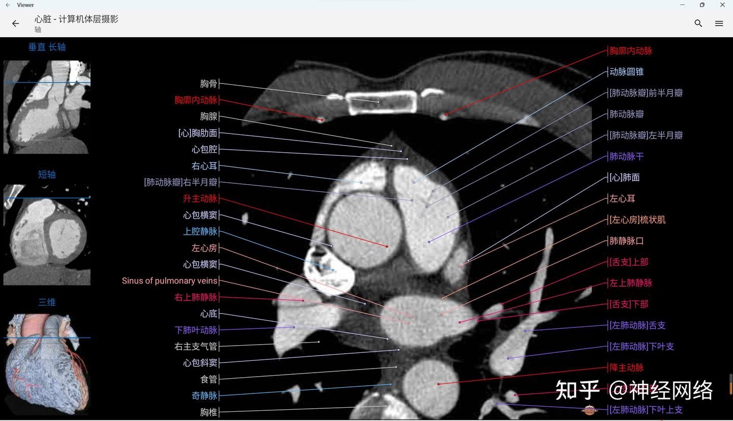 推荐一款超实用的影像软件工具 e-Anatomy（支持安卓、win11及Mac设备） - 知乎