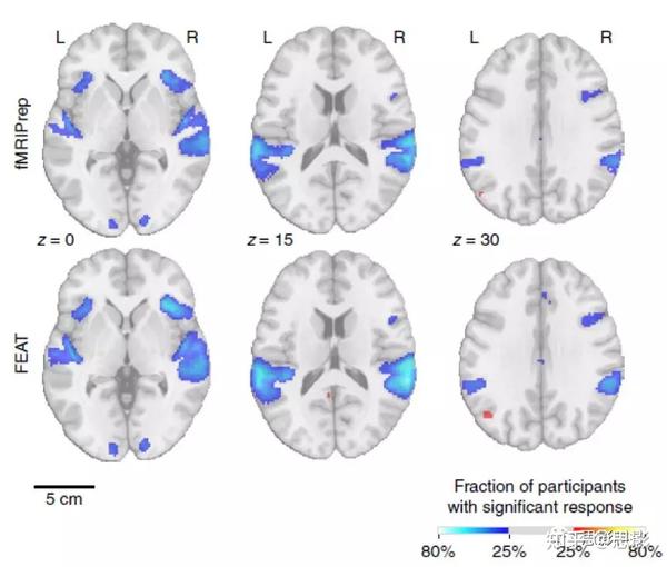 Nature Methods：fMRIPrep: 一个稳定的fMRI数据预处理工具 - 知乎
