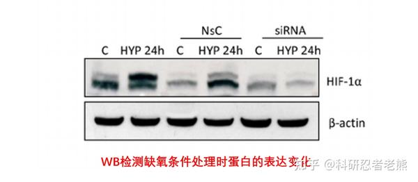 Western blot 实验大忌——稀里糊涂跑内参蛋白 - 知乎