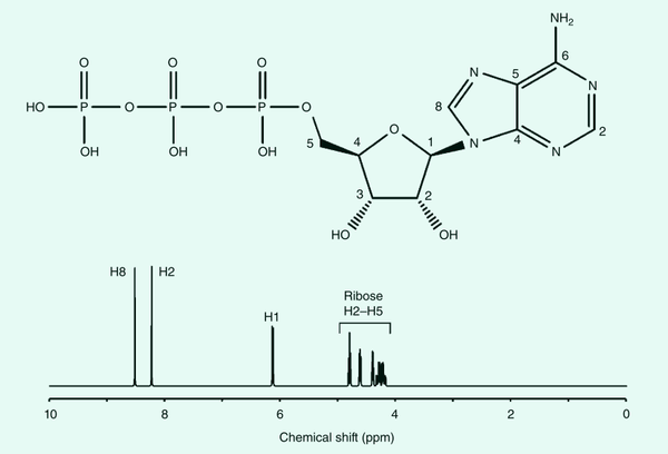 活体磁共振波谱代谢物篇 - 知乎