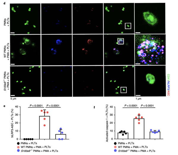 Nature最新大子刊丨脓毒症-血小板-GSDMD-NETs - 知乎
