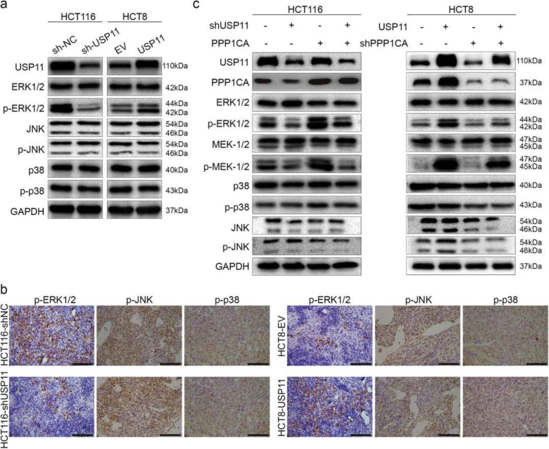 USP11通过PPP1CA介导的ERK/MAPK信号通路激活促进结直肠癌的生长和转移 - 知乎