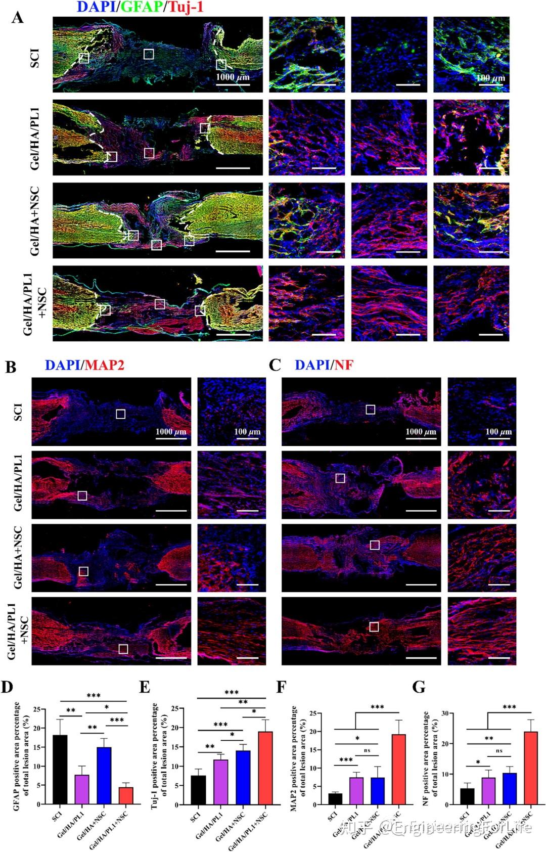 《Chem. Eng. J.》：3D打印导电脊髓仿生支架--促进神经干细胞神经元分化和脊髓修复 - 知乎