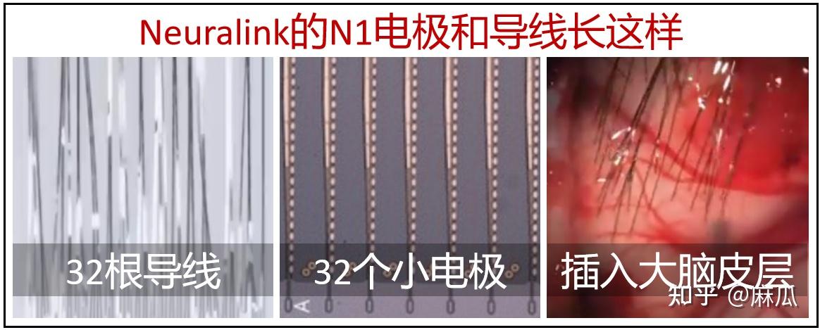 马斯克称 Neuralink 完成首例人类脑机接口设备植入，志愿者目前恢复良好，如何评价这一技术？ - 知乎