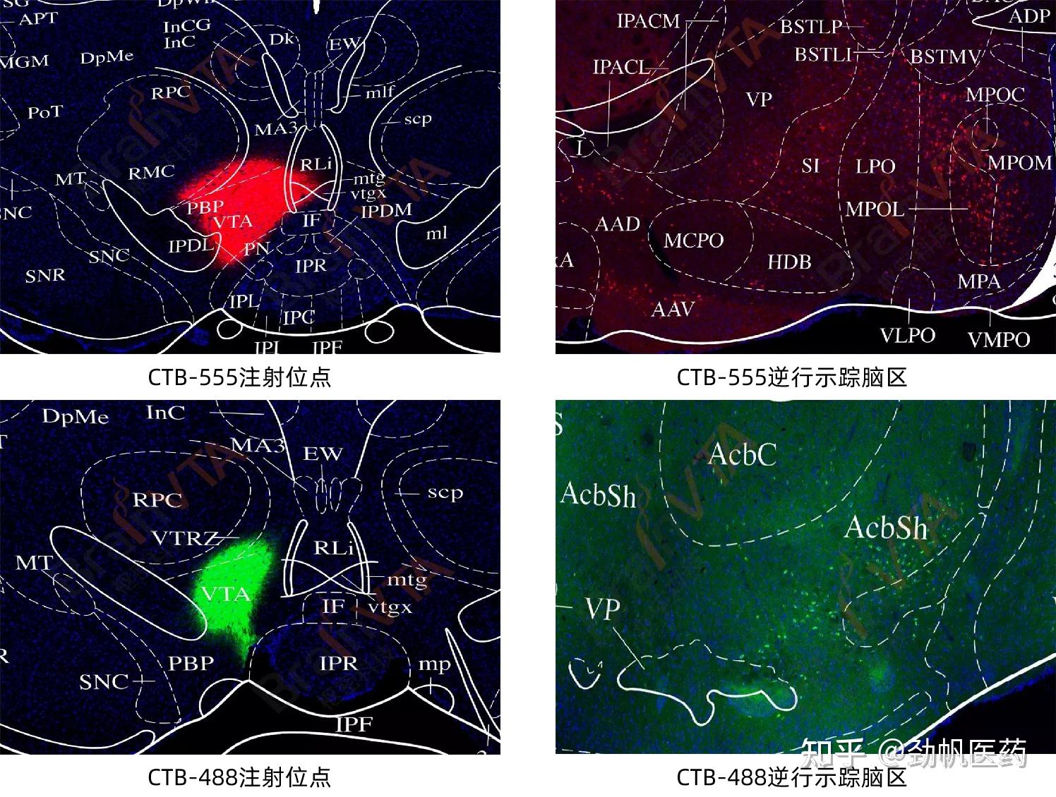 【CTB-488/CTB-555】霍乱毒素B亚基（CTB示踪剂） - 知乎