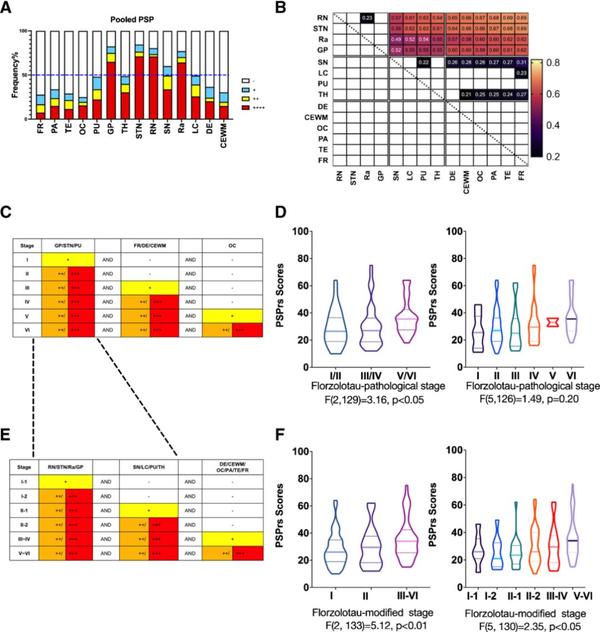 EJNMMI：PET成像显示PSP中tau病理分布模式和脑区易感性 - 知乎