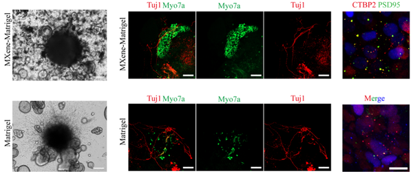 Adv Sci︱东南大学柴人杰团队在耳蜗类器官功能性毛细胞再生方面取得重要进展 - 知乎