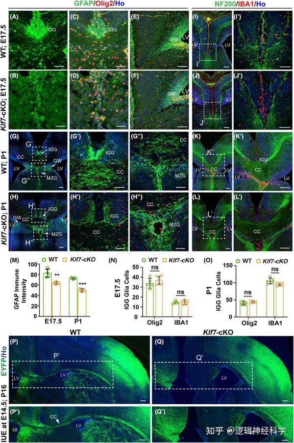 Brain Pathol︱复旦大学秦松课题组揭示转录因子KLF7调控大脑皮层神经元迁移以及胼胝体的形成的作用和机制 - 知乎