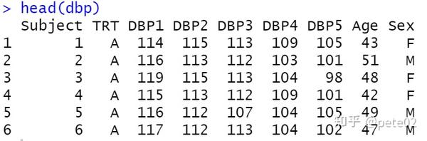 使用R语言进行t检验（t-test） - 知乎
