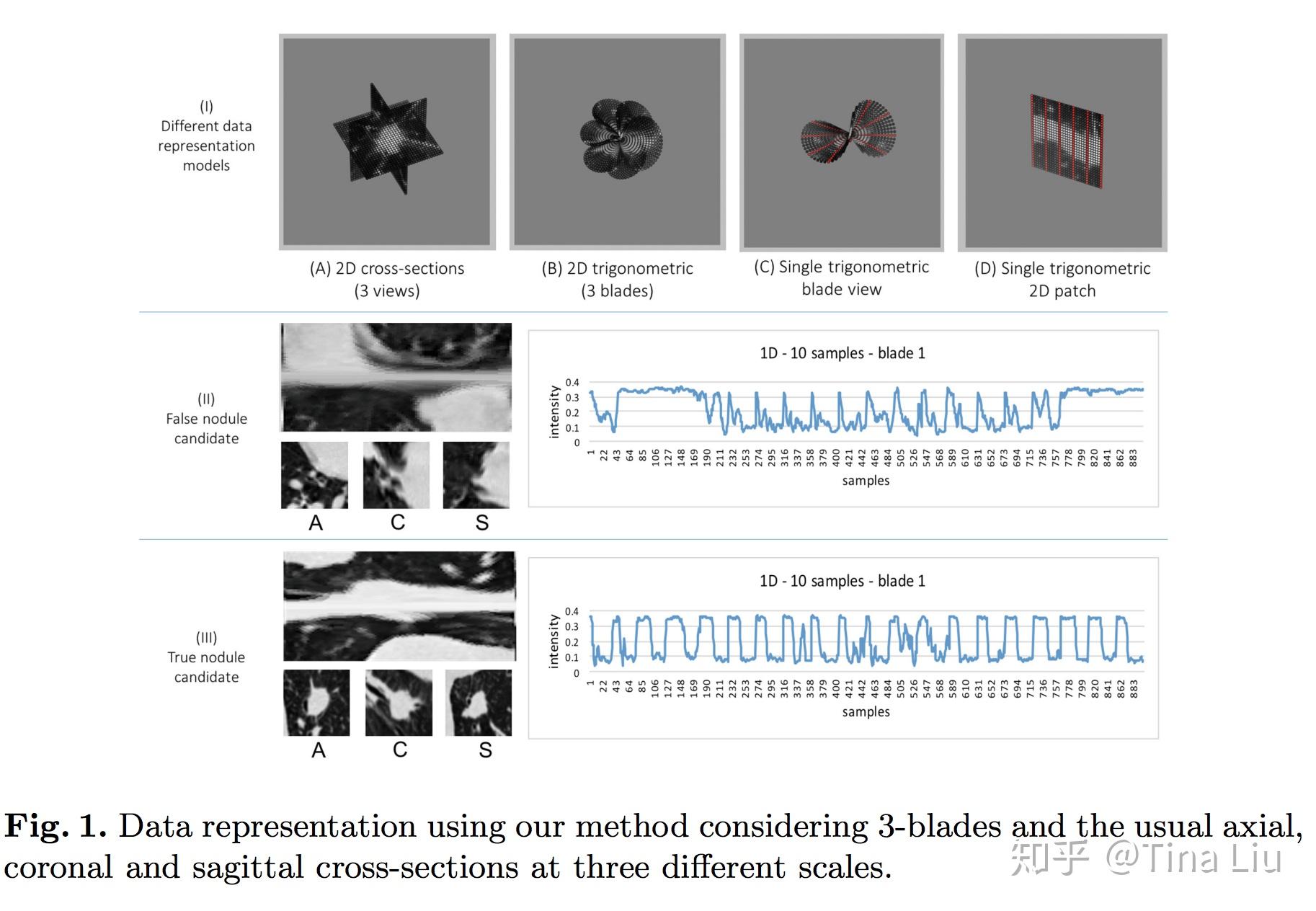 MICCAI 2018 论文之肺部肿瘤检测和分割 - 知乎