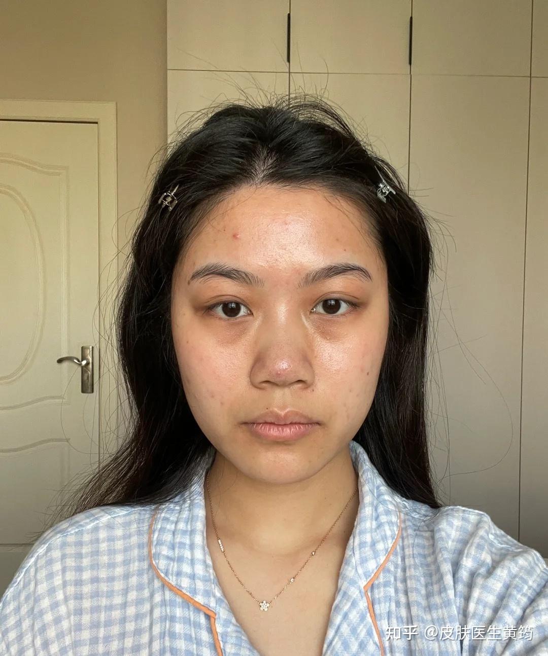 刚洗完脸，过一会脸就暗沉了！有什么办法能让脸一天都白皙透亮吗？？ 知乎