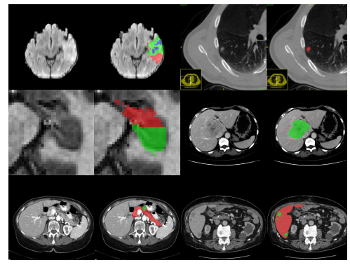 CVPR 2020 论文大盘点-医学影像处理识别篇 - 知乎