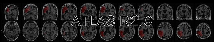 ATLAS v2.0 (ISLES 2022) 数据集介绍 - 知乎