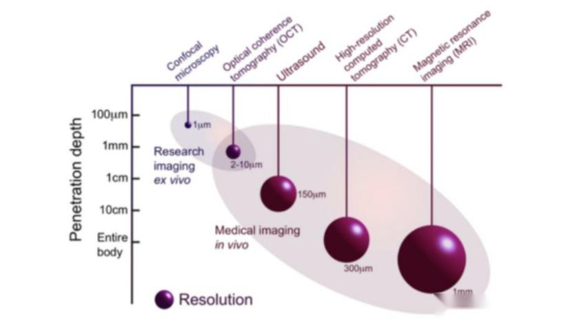 一文了解OCT全球市场 - 知乎