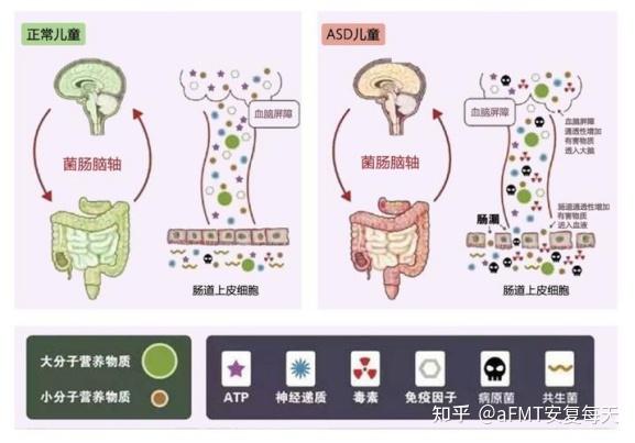 菌群移植是什么，一文带你了解FMT！ - 知乎