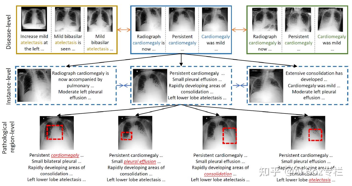 Multimodality in Medical Domain：一文速览医学多模态进展 - 知乎