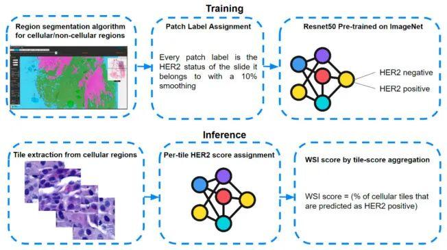 Jou Ima | AI病理挑战赛：通过HE切片图像预测乳腺癌HER2状态 - 知乎