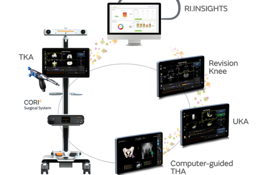 智能进阶！施乐辉手术机器人推出全新术前平台 - 知乎