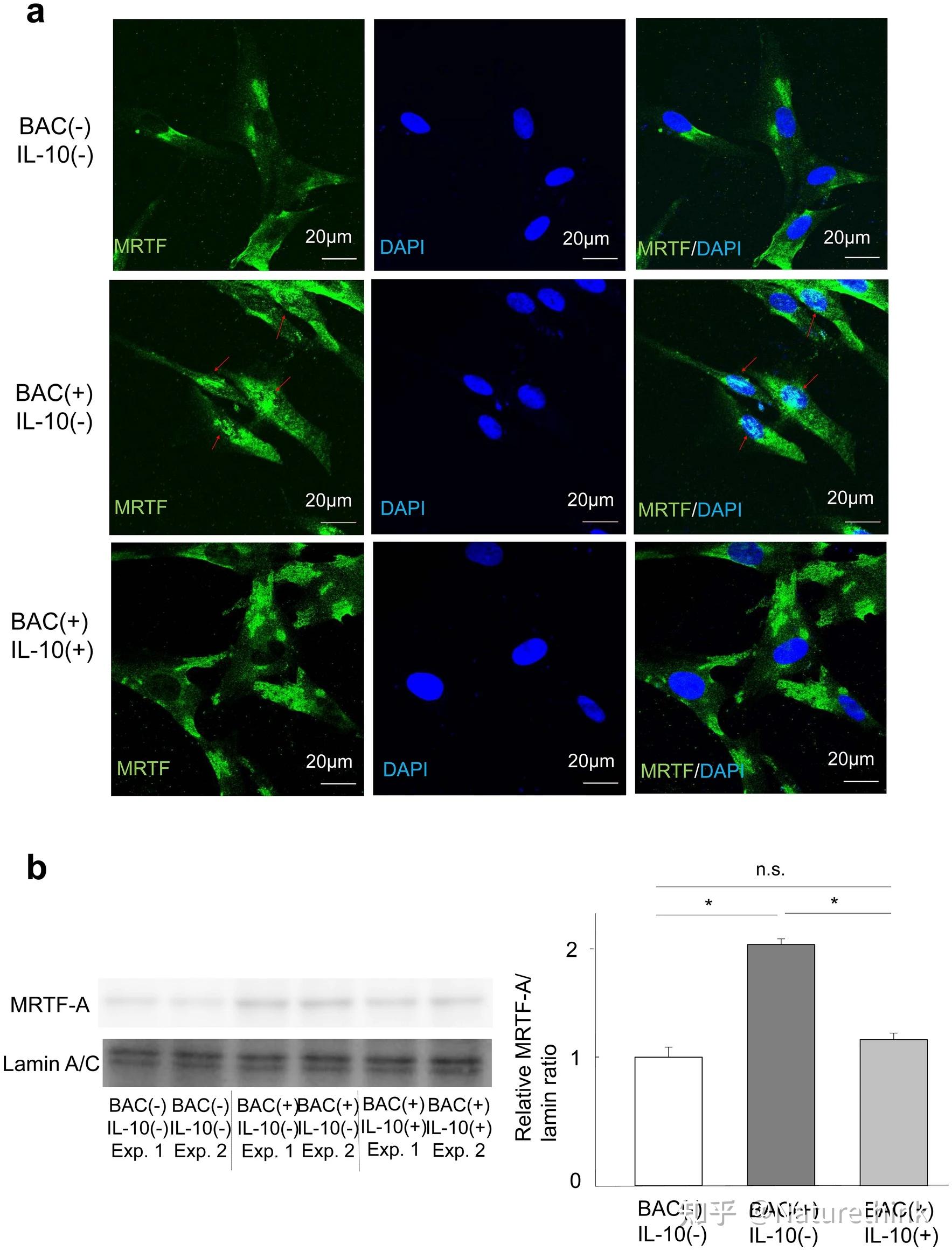 苯扎氯铵诱导的 Tenon 囊成纤维细胞的肌成纤维细胞转分化受到角膜上皮细胞共培养或白细胞介素10 的抑制 - 知乎