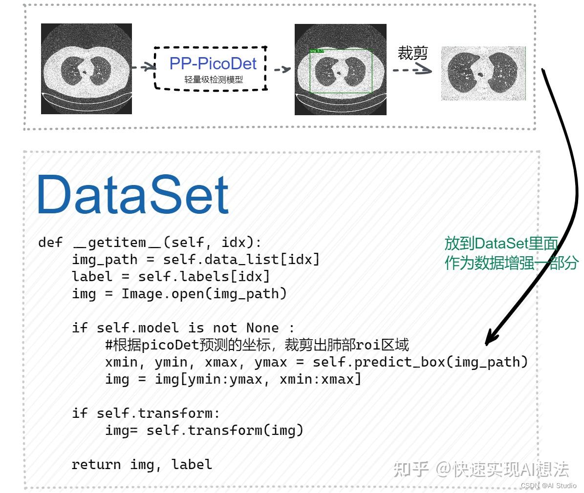 PP-PicoDet作为数据增强加入DataSet辅助肺部疾病分类 - 知乎