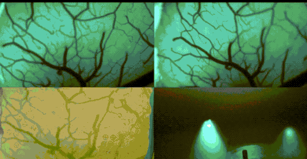 一文读懂马斯克的脑机接口硬科技-Neuralink有可能包治“脑”病吗？ - 知乎