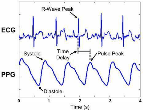 基于视频分析的rPPG心率检测综述 - 知乎