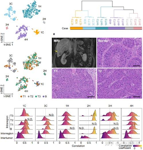 文献详解丨肿瘤与免疫细胞互作好比锁钥？这篇NC文章把scRNA-seq玩出新花样 - 知乎