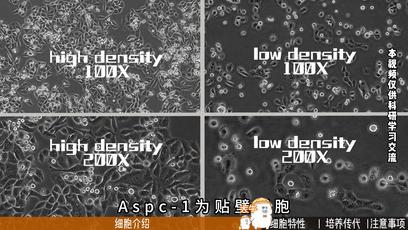 Aspc-1细胞培养，人胰腺癌细胞培养攻略 - 丰晖生物 - 知乎