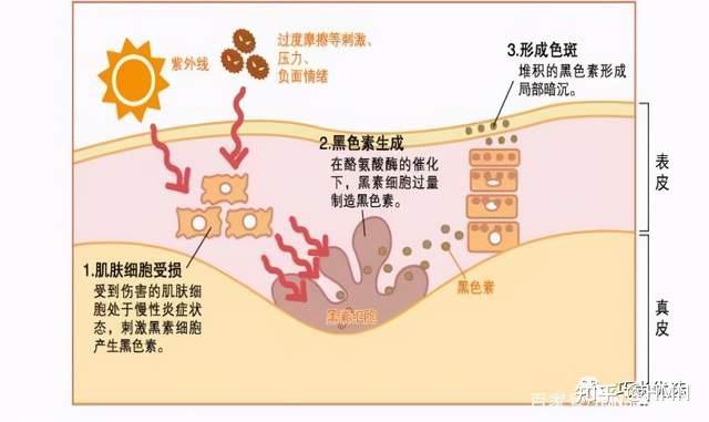 皮肤新陈代谢差会有哪些症状? 知乎