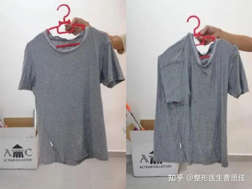 MD Codes 注射法，我为什么不教！ - 知乎