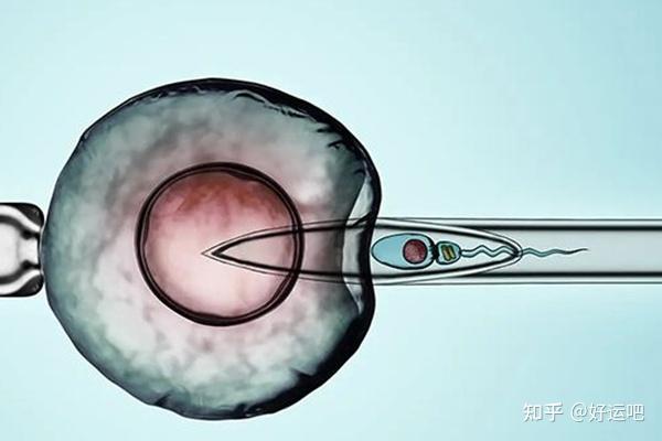 什么是卵胞浆内单精子注射（ICSI）？ - 知乎