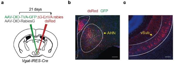 【知识窗】RV逆行跨一级示踪技术详解 - 知乎