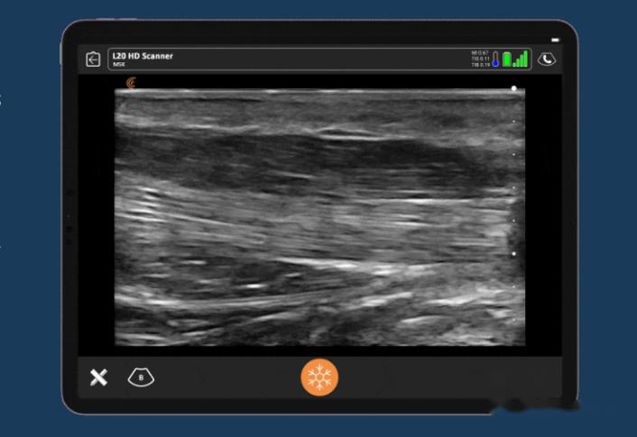 全球首个！FDA批准的手持式经食道超声心动图系统 - 知乎