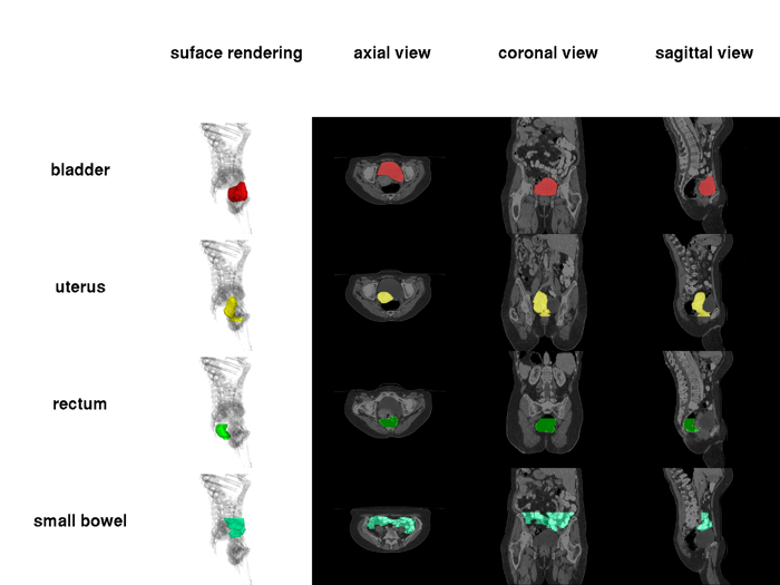BTCV Cervix 数据集介绍 - 知乎
