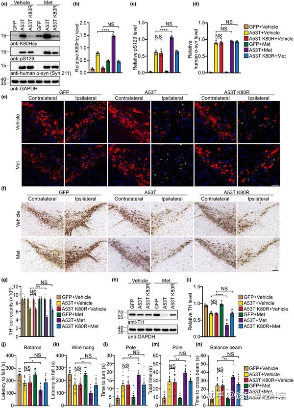 Aging Cell︱武汉大学人民医院张振涛团队揭示同型半胱氨酸修饰α-突触核蛋白在帕金森病中的作用 - 知乎