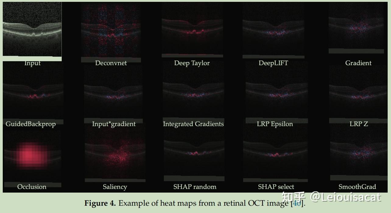 论文阅读：Explainable Deep Learning Models in Medical Image Analysis - 知乎